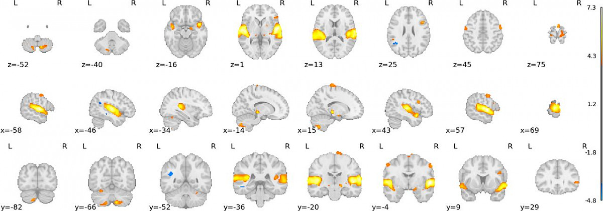 Proposal ID 2636 - Playback the music of the brain - decoding emotions ...