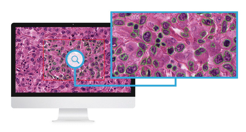 Digital Pathology